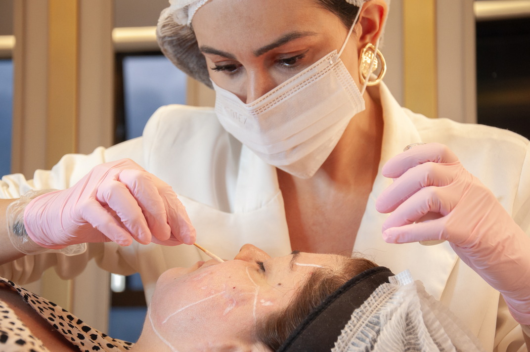 Peeling ATA (AT) - dralucianamamud.com.br